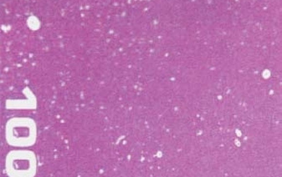 Diagnostic Chart & Troubleshooting Guide for Flexo Printing Defects