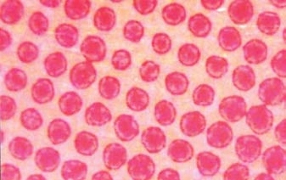 8 Dot Gain Factors Causing Your Flexo Printing Defects